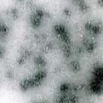 Crop Protection >> Diseases >> Grassy Stunt & Ragged Stunt Virus